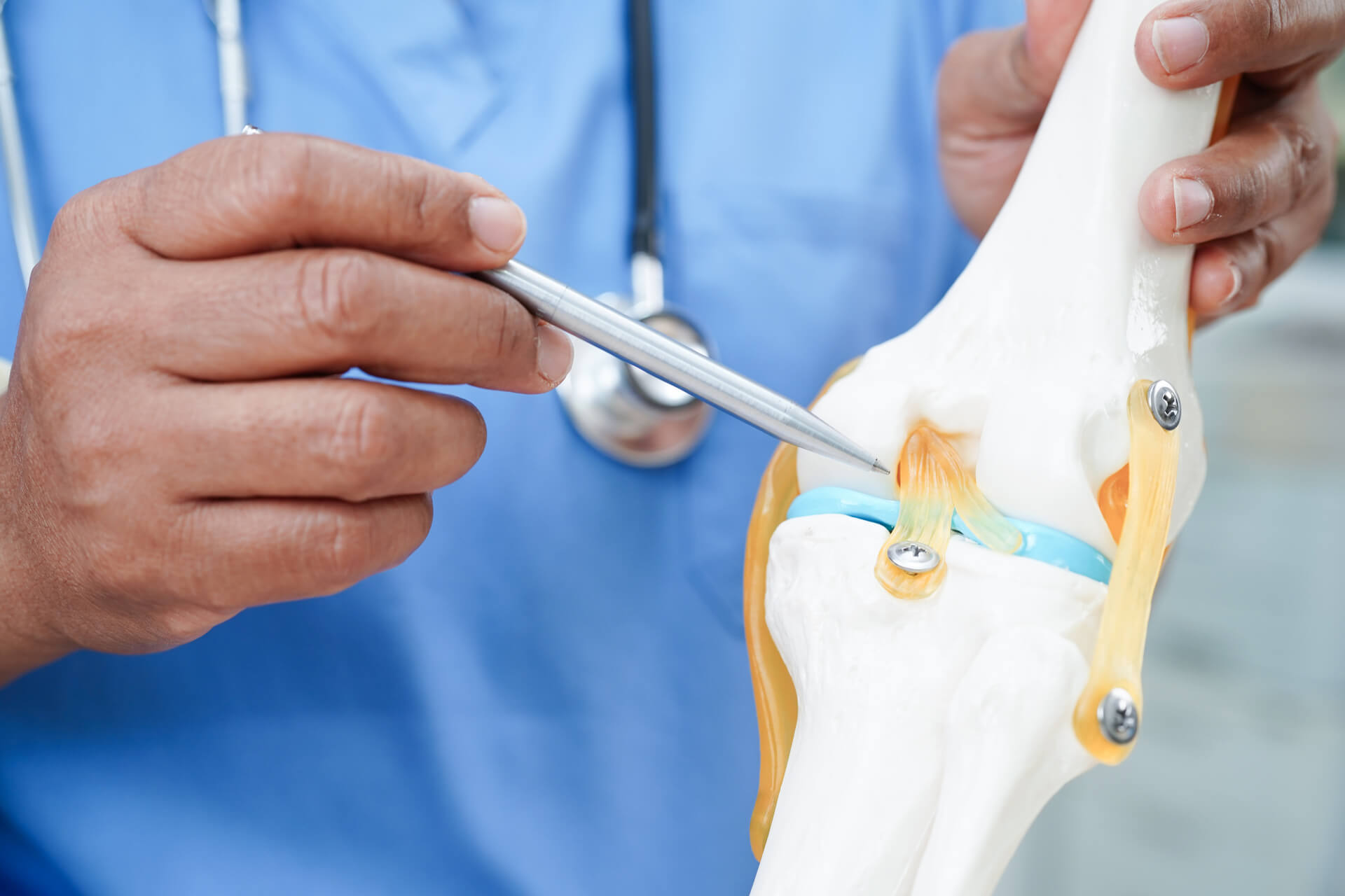 Foot Problems After Knee Replacement Hip Knee Orthopaedics
